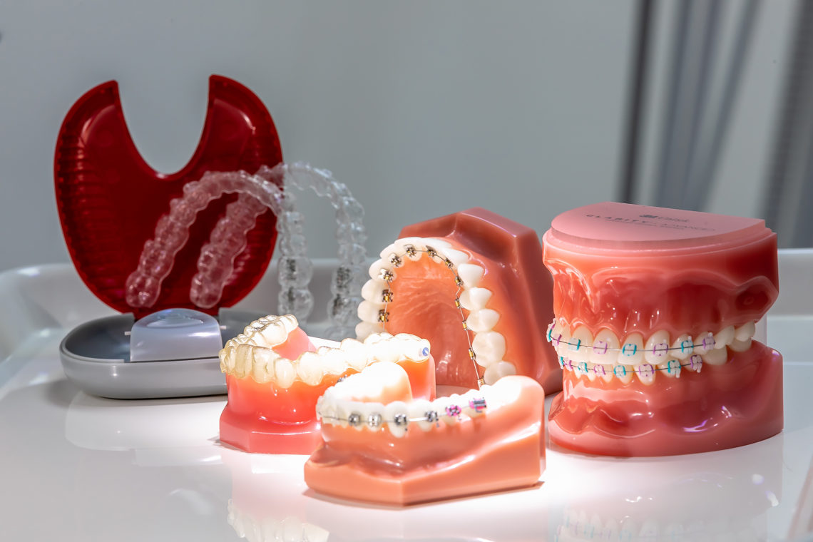 Our Different Orthodontic Appliances - Orthodontist Cannes - Dr Hayat ...